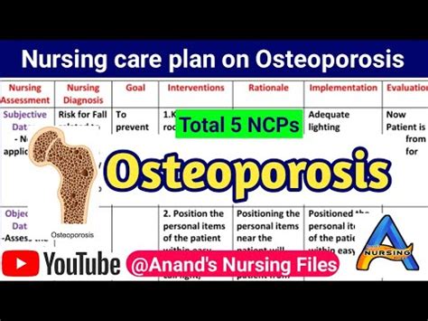 Nursing Care Plan On Osteoporosis What Is The Nursing Care Plan For