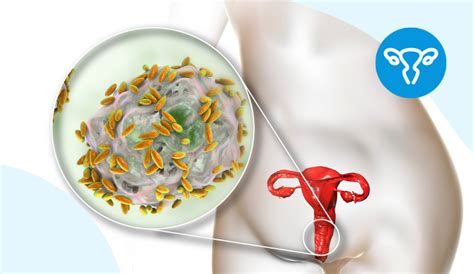 Vaginosi Sintomi Cura E Prevenzione Doctolib