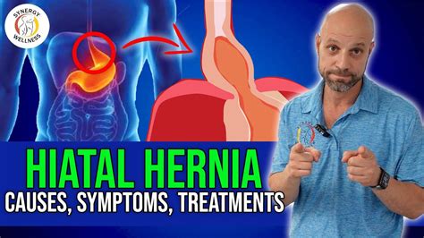 Understanding Hiatal Hernia Causes Symptoms Diagnostic Tests