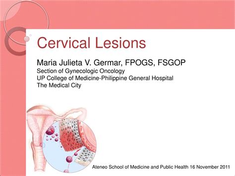 Benign Cervical Lesions