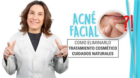 Cómo eliminar los Granos en la Cara Tratamiento Trucos y Consejos