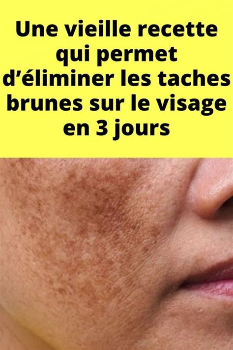 LES TACHES BRUNES ONT UNE APPARENCE DISGRACIEUSE ET SONT LEUR VÉRITABLE