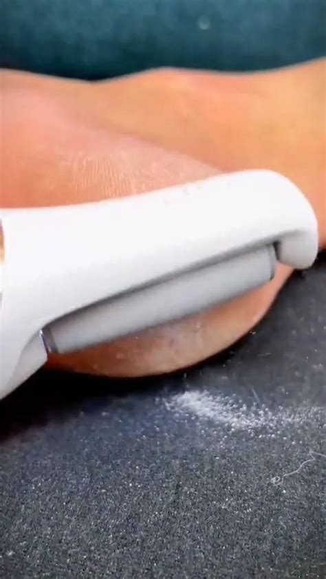 Pin Auf Dicas De