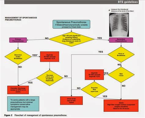 Emergency Medicine BTS Guidelines For Management Of Pneumothorax