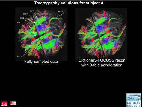 nuit blanche accelerated dsi with compressed sensing using adaptive dictionaries implementation