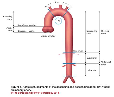 Valvular Emergencies Part Diagnosis And Management Of Severe Aortic