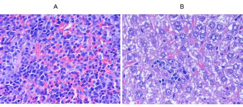 Participation Of Candida Albicans Transcription Factor Rlm In Cell