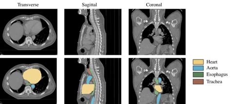 typical ct scan with manual segmentation some organs like the download scientific diagram