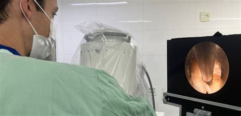 HNSC realiza a primeira cirurgia de coluna por vídeo procedimento foi