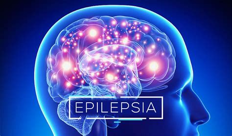 INTRODUCCIÓN A LA NEUROPSICOLOGÍA Mind Map