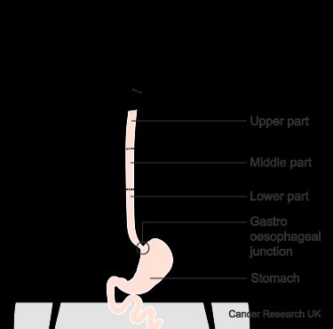 About Stages Types And Grades Of Oesophageal Cancer Cancer Research Uk