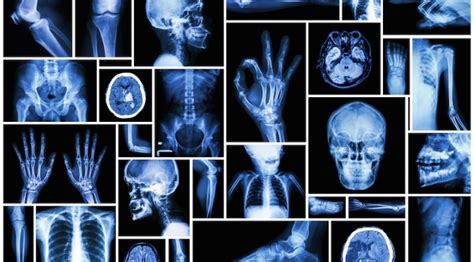 Un portail dimagerie médicale pour les patients et les médecins
