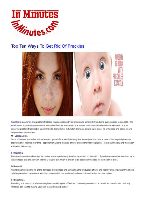 My Publications Top Ten Ways To Get Rid Of Freckles Page 1
