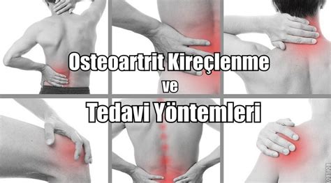 Osteoartrit Kireçlenme ve Tedavi Yöntemleri