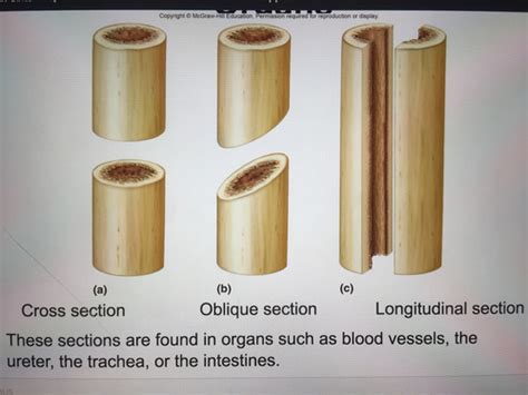 A P Lecture Exam Flashcards Quizlet