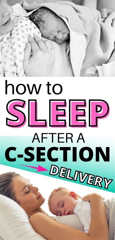 Pin On C Section Recovery