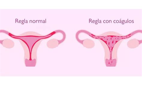 Son normales los coágulos en la menstruación Descubre la verdad