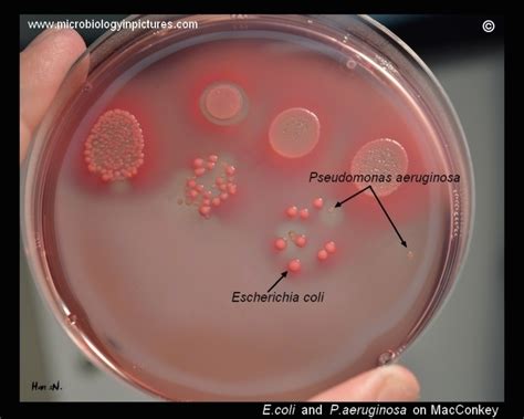 Pseudomonas Aeruginosa Emb Agar