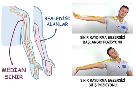 Sinir Sıkışması Tedavisi Kadıköy Fizik Tedavi Merkezi