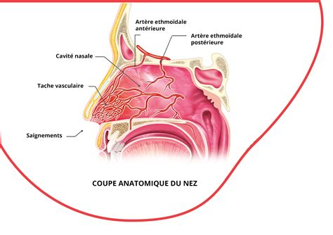 Saignements De Nez Stop Hemo