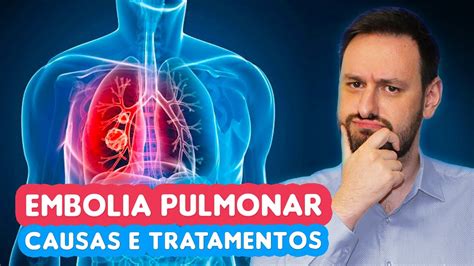 Causas De La Embolia Pulmonar