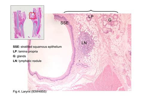 Lamina Propria Vocal Folds