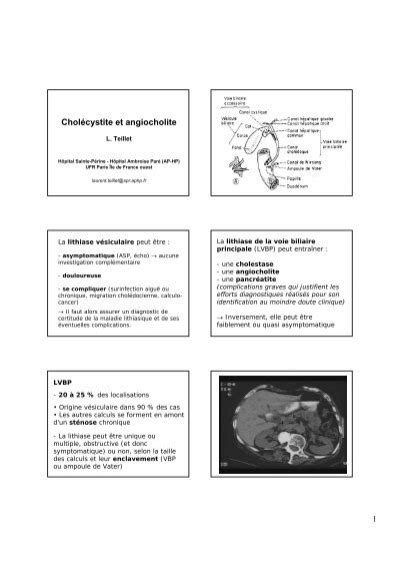 Cholécystite et angiocholite longue vie et autonomie HEGP