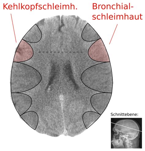 Schwebekonstellation Bn Wiki Neue Medizin Wiki