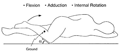 Piriformis Muscle Injection Procedure Sports Medicine Review
