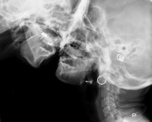 Sexrays An Artist X Rayed Sexual Acts Of People Goes Viral Lifecrust