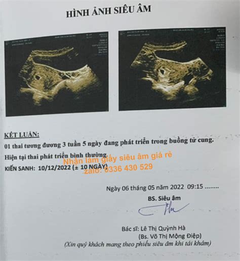 Gi Y Kh M Thai Gi B N Tr N Lan C Ng Khai Tr N Ch M Ng