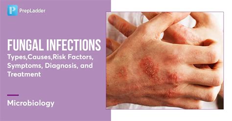 Fungal Skin Rash Treatment