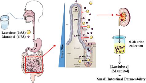 Frontiers The Role Of Intestinal Permeability In Gastrointestinal