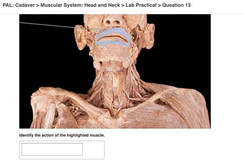 Solved PAL Cadaver Muscular System Head And Neck Lab Chegg