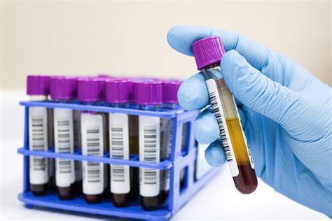 La acreditación del Laboratorio Clínico y Banco de Sangre de la UCR