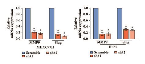 PHF5A is involved in HCC progression via the NF κB signaling a The