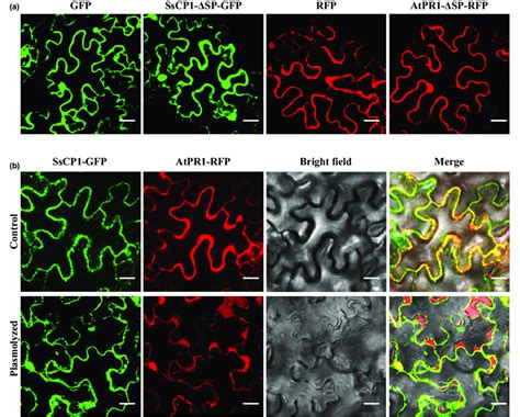 Subcellular Localization Of SsCP1 And AtPR1 In Nicotiana Benthamiana