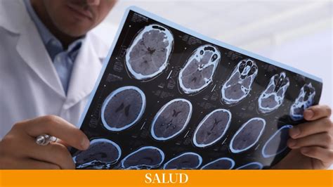 Desarrollan Un Nuevo M Todo Para Detectar Problemas De Circulaci N