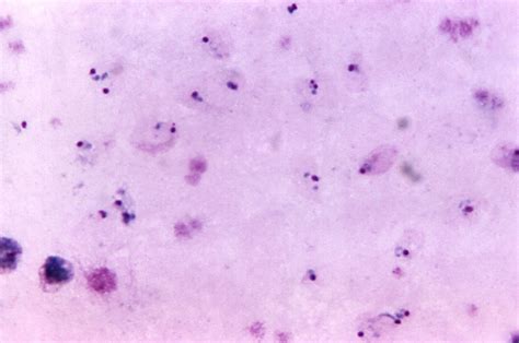 Plasmodium Falciparum Gametocyte