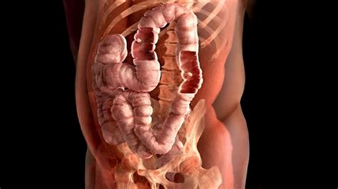 Stage Colon Cancer Big Discount Gbu Hamovniki Ru
