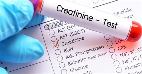Quelles sont les causes des taux de créatinine élevés blog santé