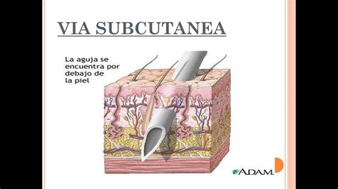 COMO APLICAR UNA INYECCION POR VIA SUBCUTANEA YouTube