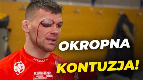 Boli od patrzenia Rozbity Łukasz Charzewski pokazał ogromne serce na