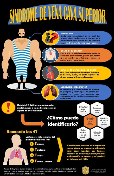 DIVULGACIÓN CIENTÍFICA UG Síndrome de Vena Cava Superior