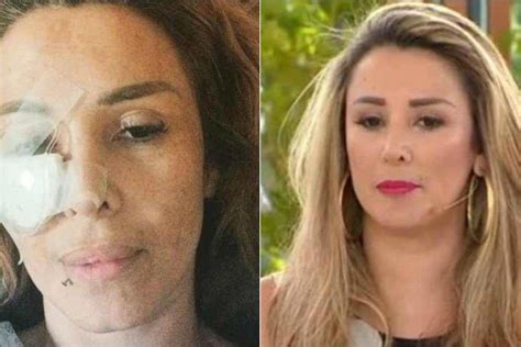 Est Grave El Delicado Estado De Salud De Romina S Ez Tras Brutal