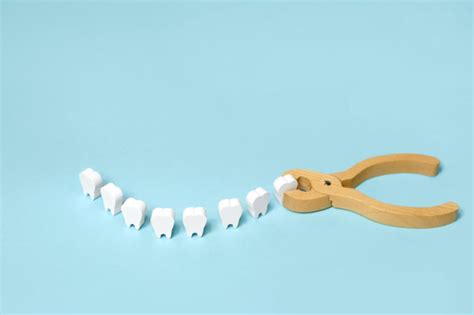 Muelas del juicio curiosidades Clínicas Dentales Nimo