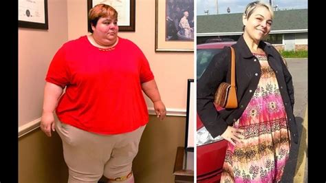 Perderam até 200 kg os mais inacreditáveis antes e depois do