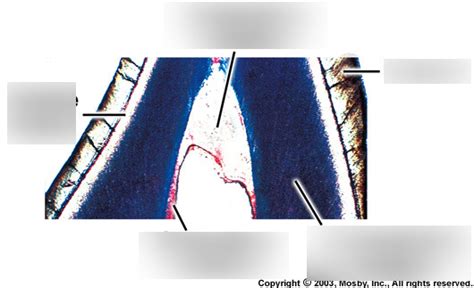Dental Oral Histology And Embryology Chapter 13 Part 1 Dentin Diagram