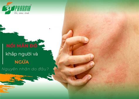 11 nguyên nhân gây ra nổi mẩn ngứa khắp người Và cách điều trị