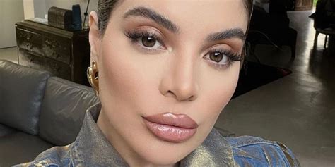 Arrependidos Da Harmoniza O Facial Famosos Buscam Reverter